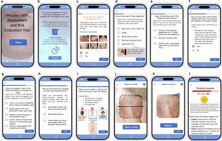 Mobile-accessible deep learning-based self-assessment tool for measles ...
